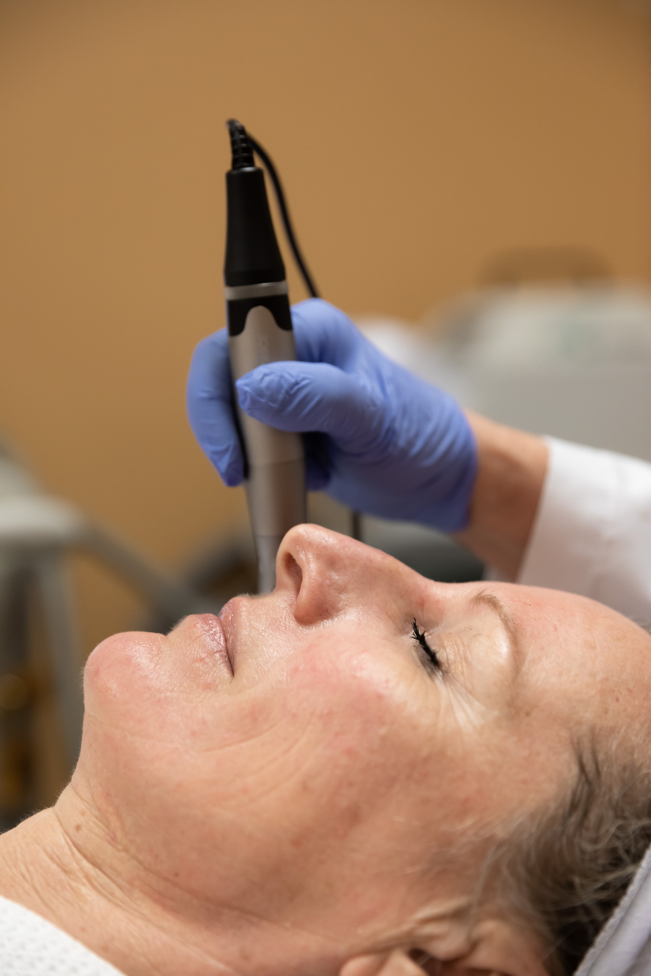 Skinwave Facial in Windermere | Lumina Vein & Aesthetic Institute